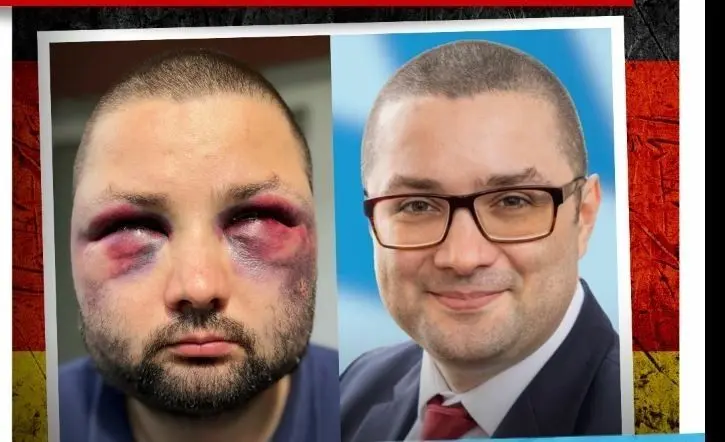 Prügel-Attacke auf Andreas Jurca (AfD) in Augsburg: Warum es Zweifel am ...